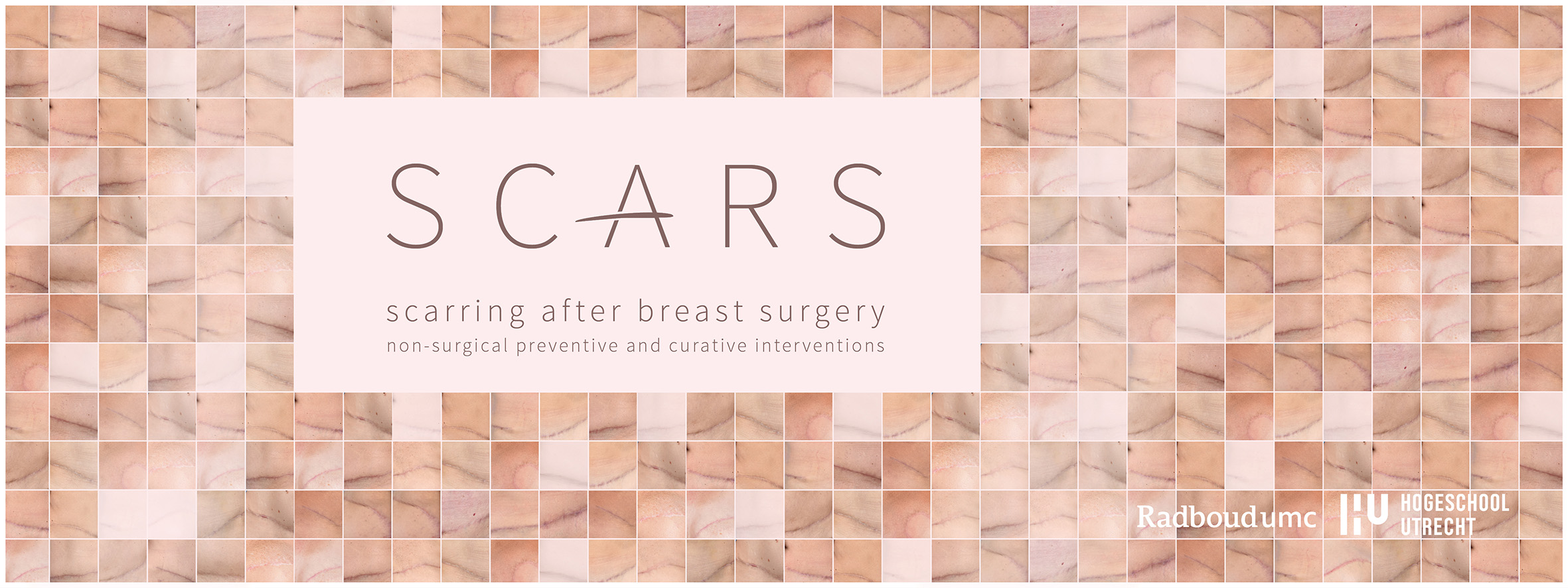How to treat scars after Breast Reconstructive Surgery | HU University ...